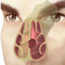 Nasal Septal Perforation - Causes, Symptoms and Repair Options